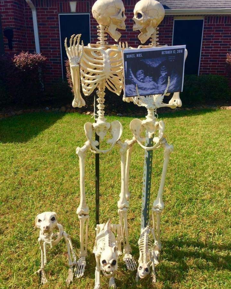 Skeleton Meme - 99+ Ảnh Chế Skull Viral 💀